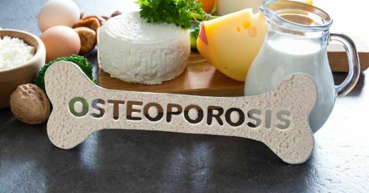 Osteoporosi: il ruolo dell’alimentazione e dell’attività fisica nella prevenzion - STUDIO MEDICO ...
